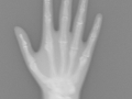 Radiation Protection During Mobile Exams